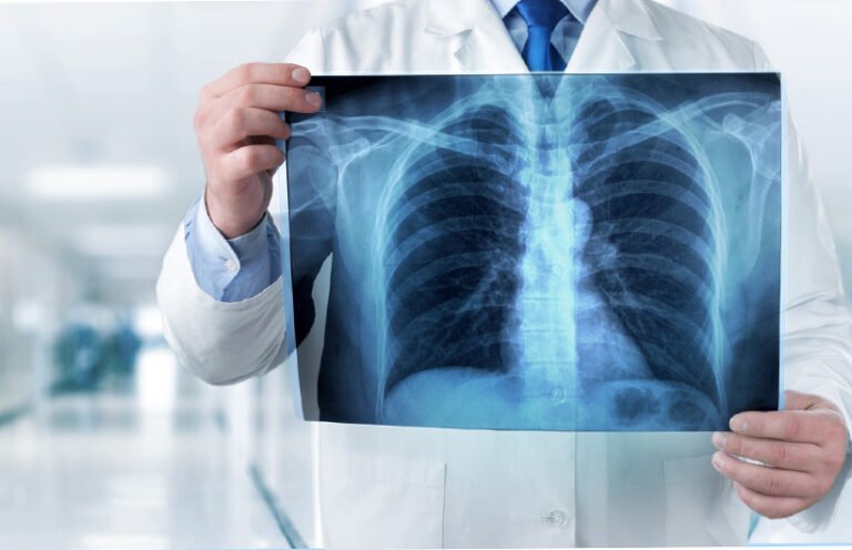 ECMO Treatment in Hyderabad | Dr Kunal Waghray